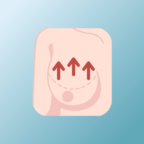Breast Lifting AR - Aesthecenter Find Best Clinic for You